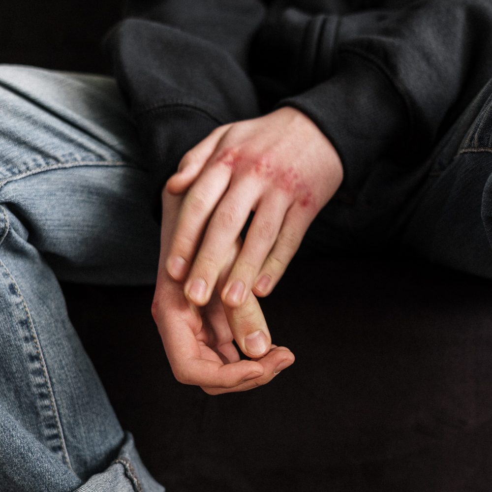 Aggressionen- psychologische Behandlung in Berlin